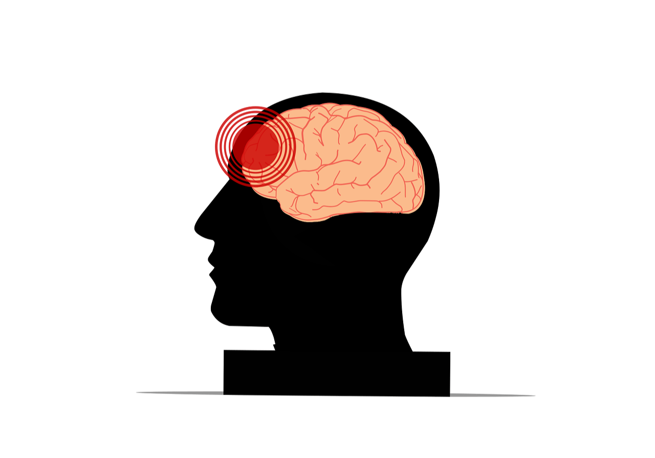 Understanding Concussions: What Really Happens in Your Brain